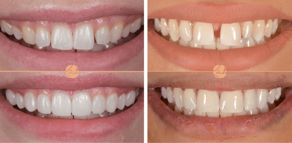 Cosmetic Dentistry | Smile Makeover Specialists UK | Ruh Dental