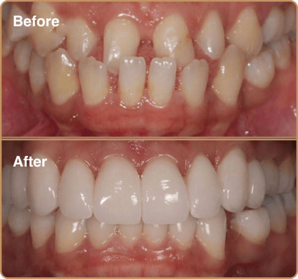 Smile Gallery | Ruh Dental