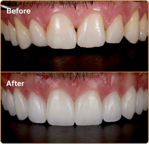 Smile Gallery | Ruh Dental